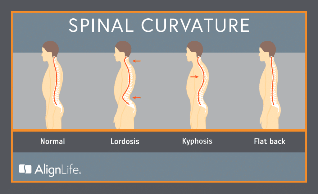 Curves Matter: Does Your Spine Pass the Test?