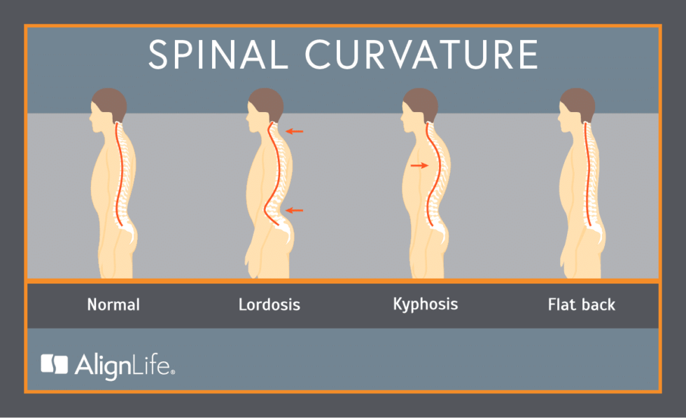 Curves Matter: Does Your Spine Pass the Test?