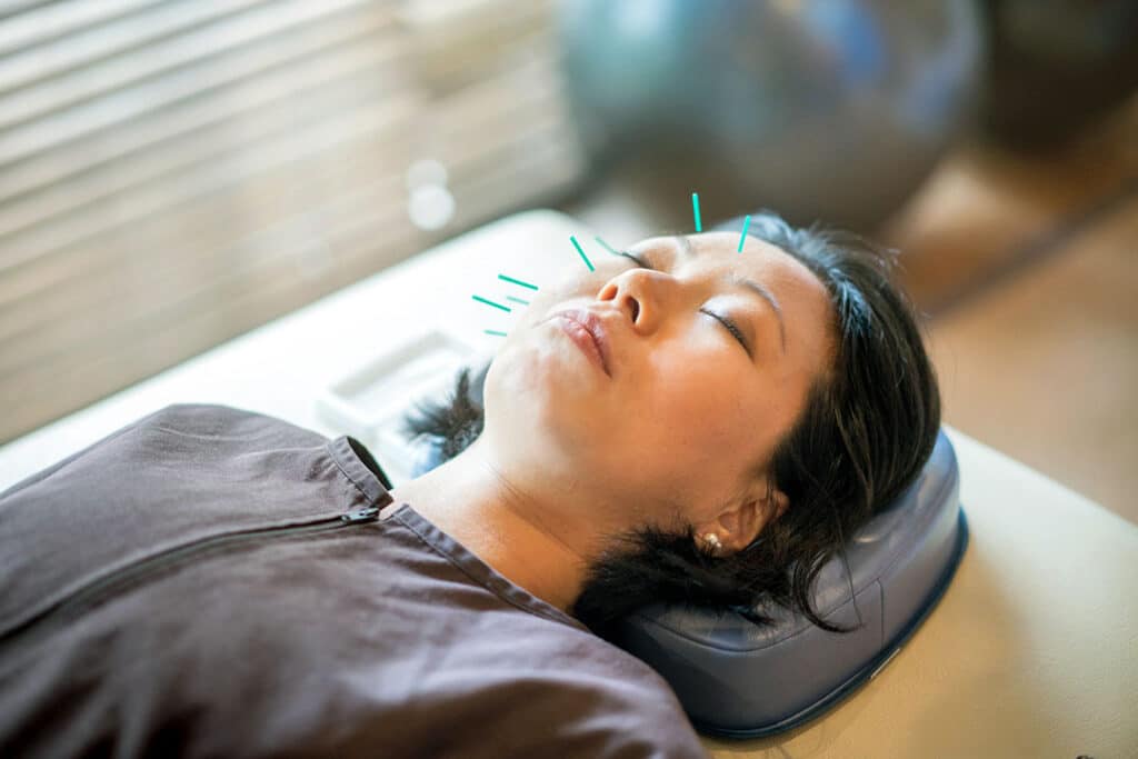 10 Evidence-Based Health Benefits of Acupuncture | AlignLife