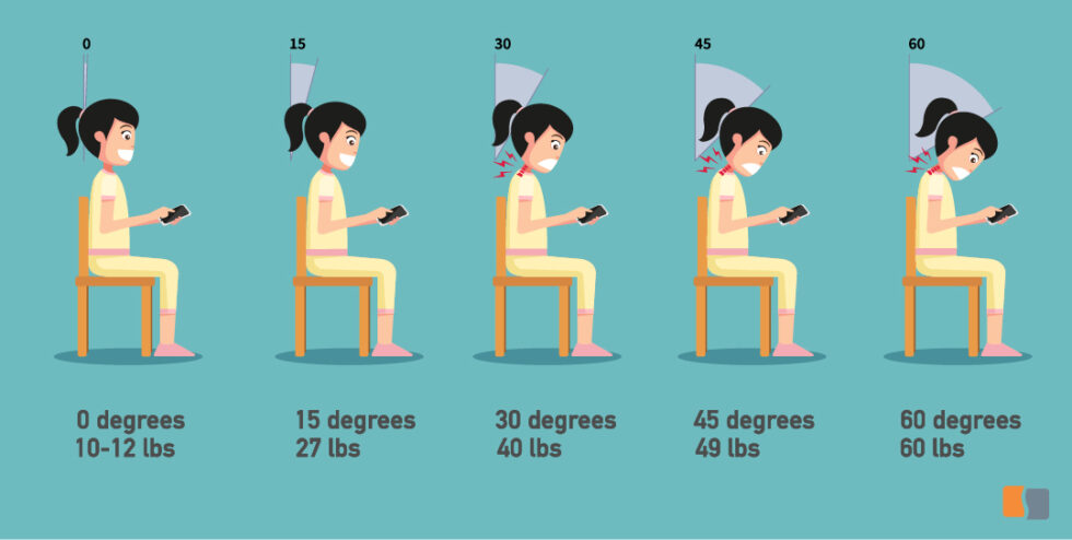 8 Signs You Have Tech Neck & How to Get Rid of It | AlignLife